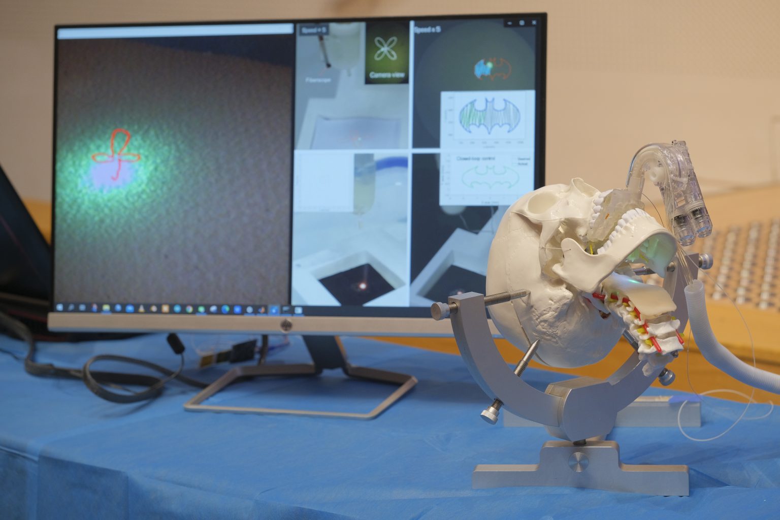 Soft Robotic Manipulator for Intra-operative MRI-guided Transoral Laser ...