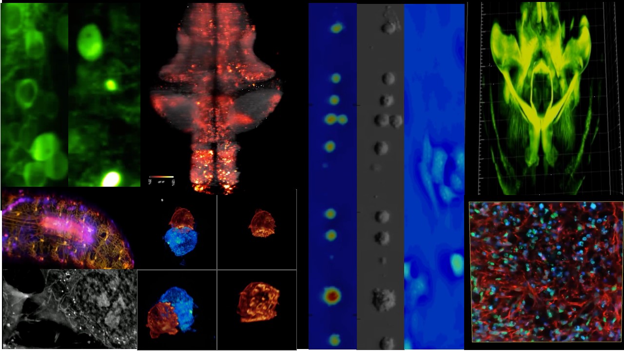 Tech Talk – Seeing the unseen in biomedicine with laser – Innovation Wing